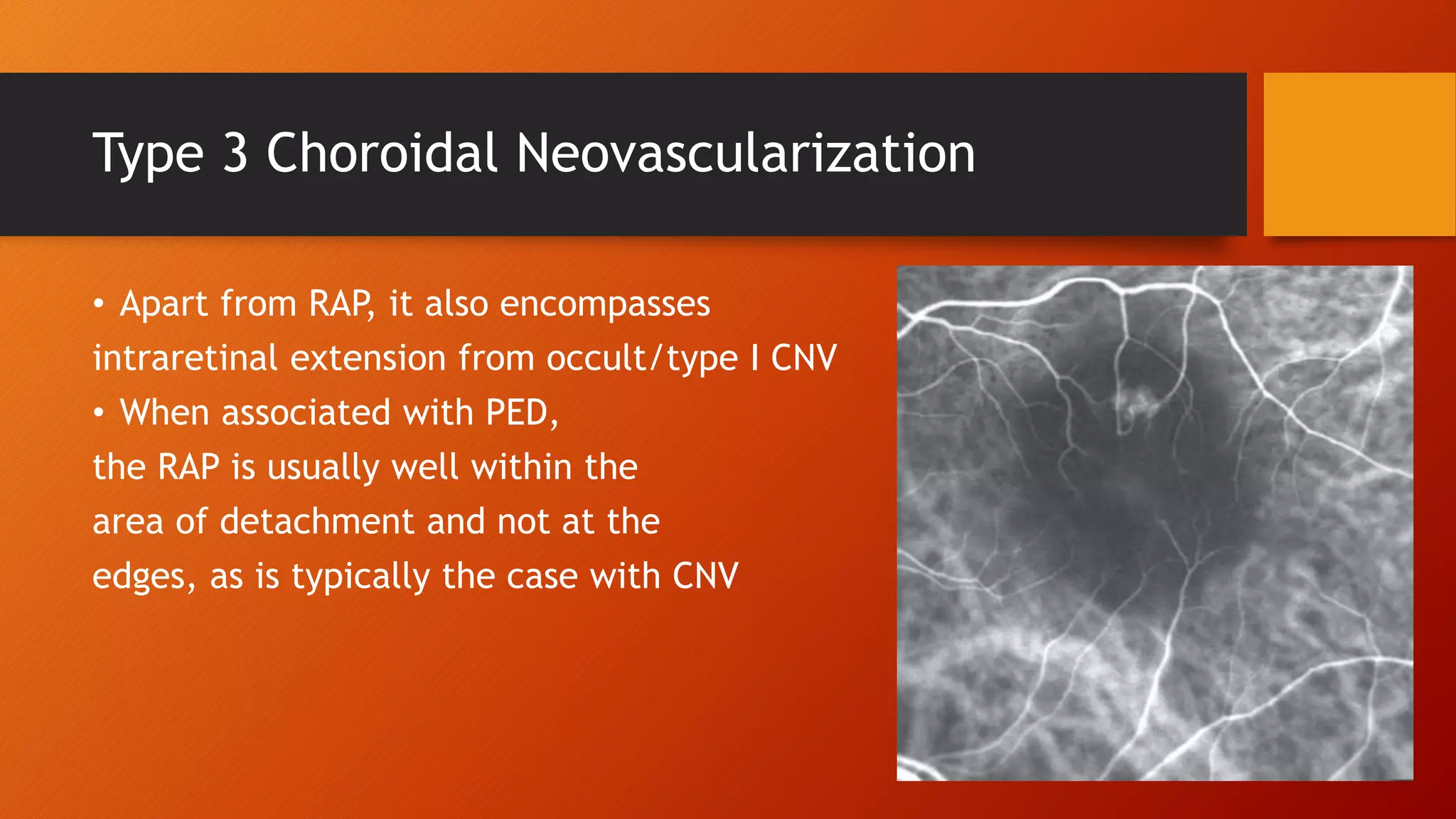 Indocyanine green angiography | PPTX