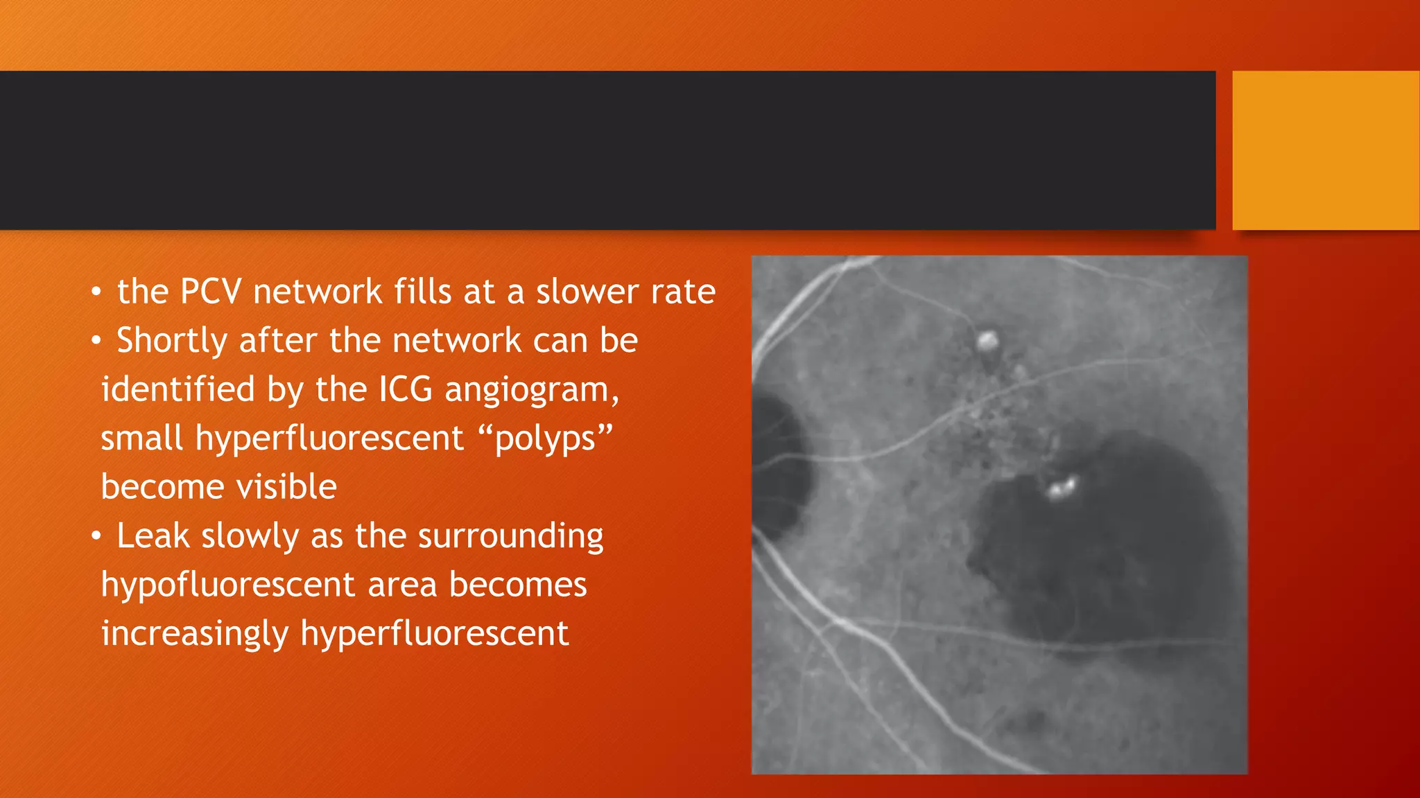 Indocyanine green angiography | PPTX