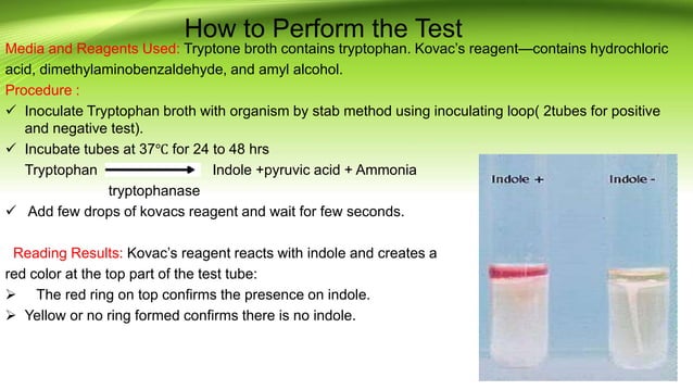Indole test