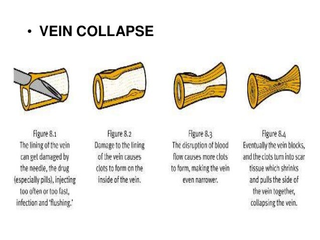 Indonesia assist and hr2014