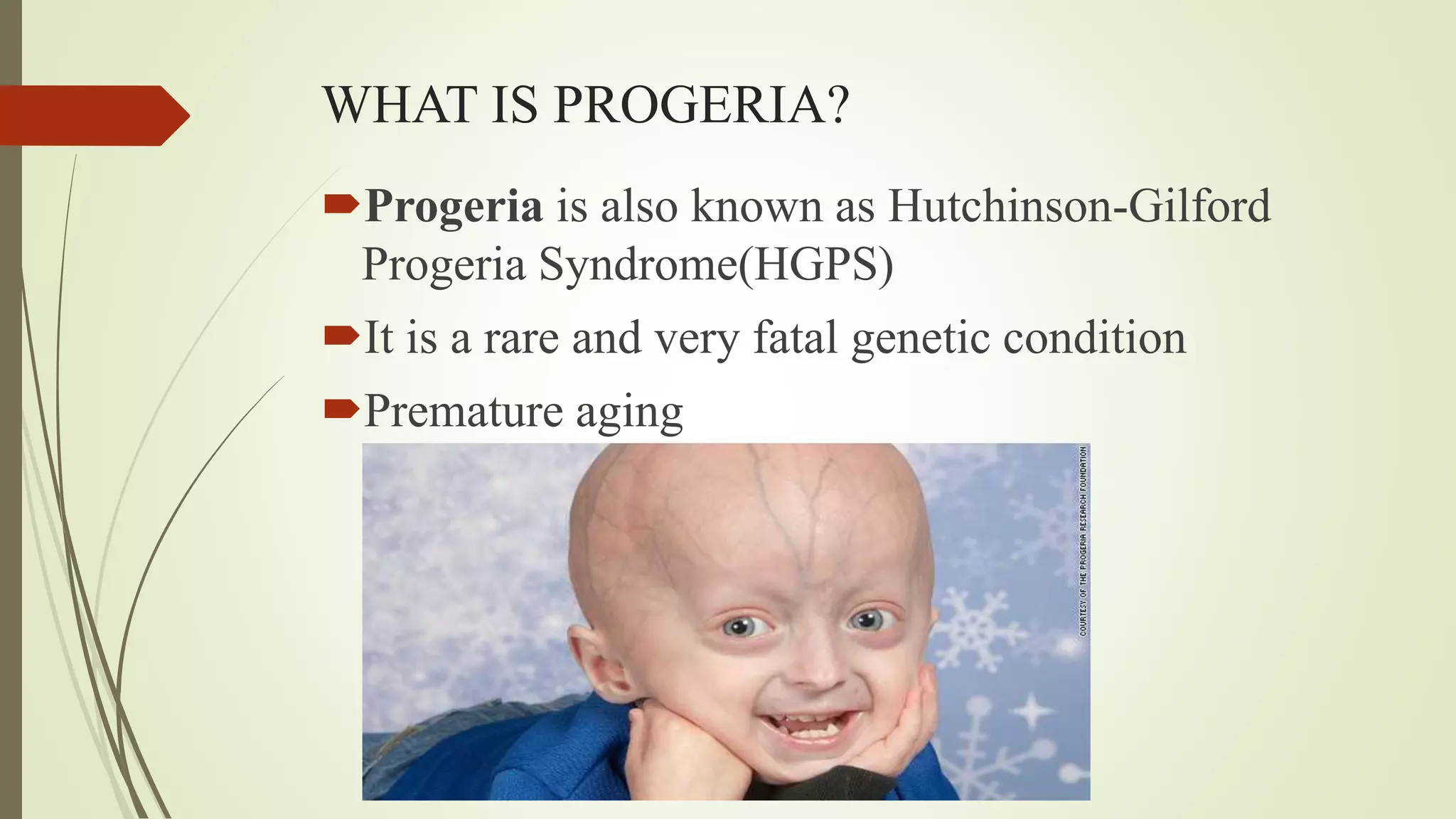 PROGERIA | PPT | Free Download