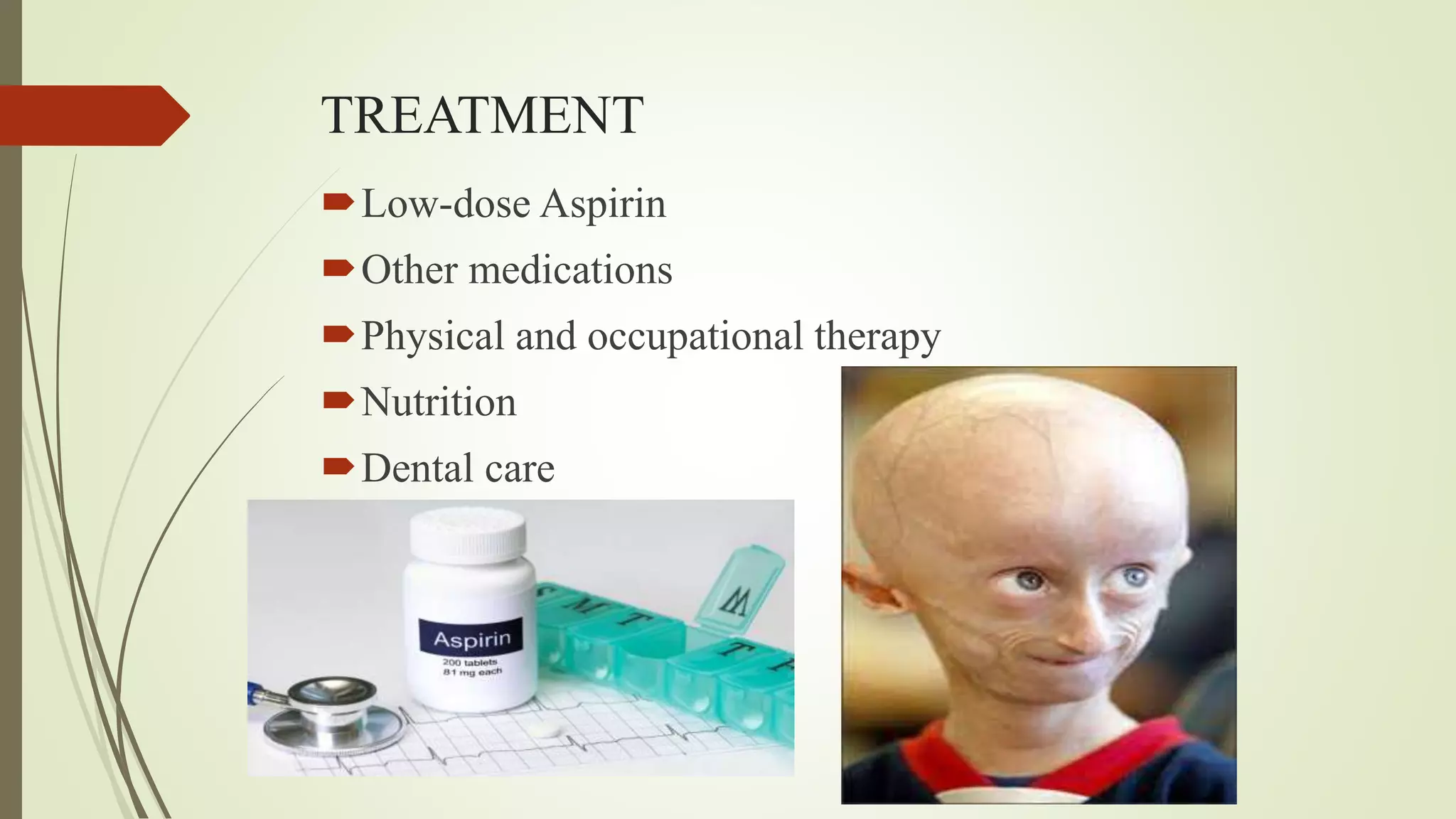 PROGERIA | PPT | Free Download
