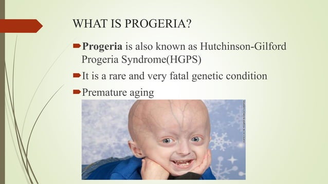 PROGERIA | PPT
