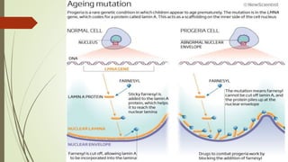 PROGERIA | PPTX