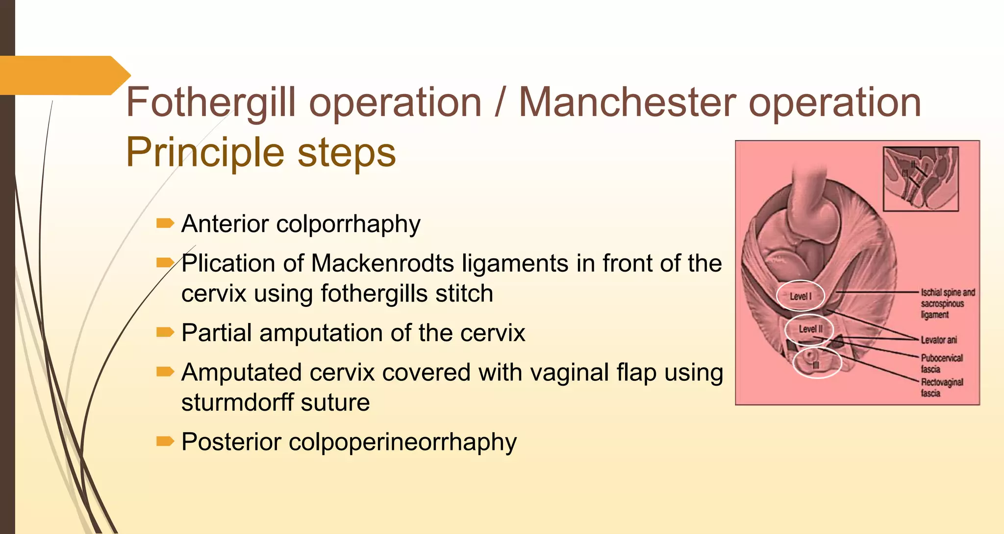 Classification & conservative surgeries for prolapse | PPTX