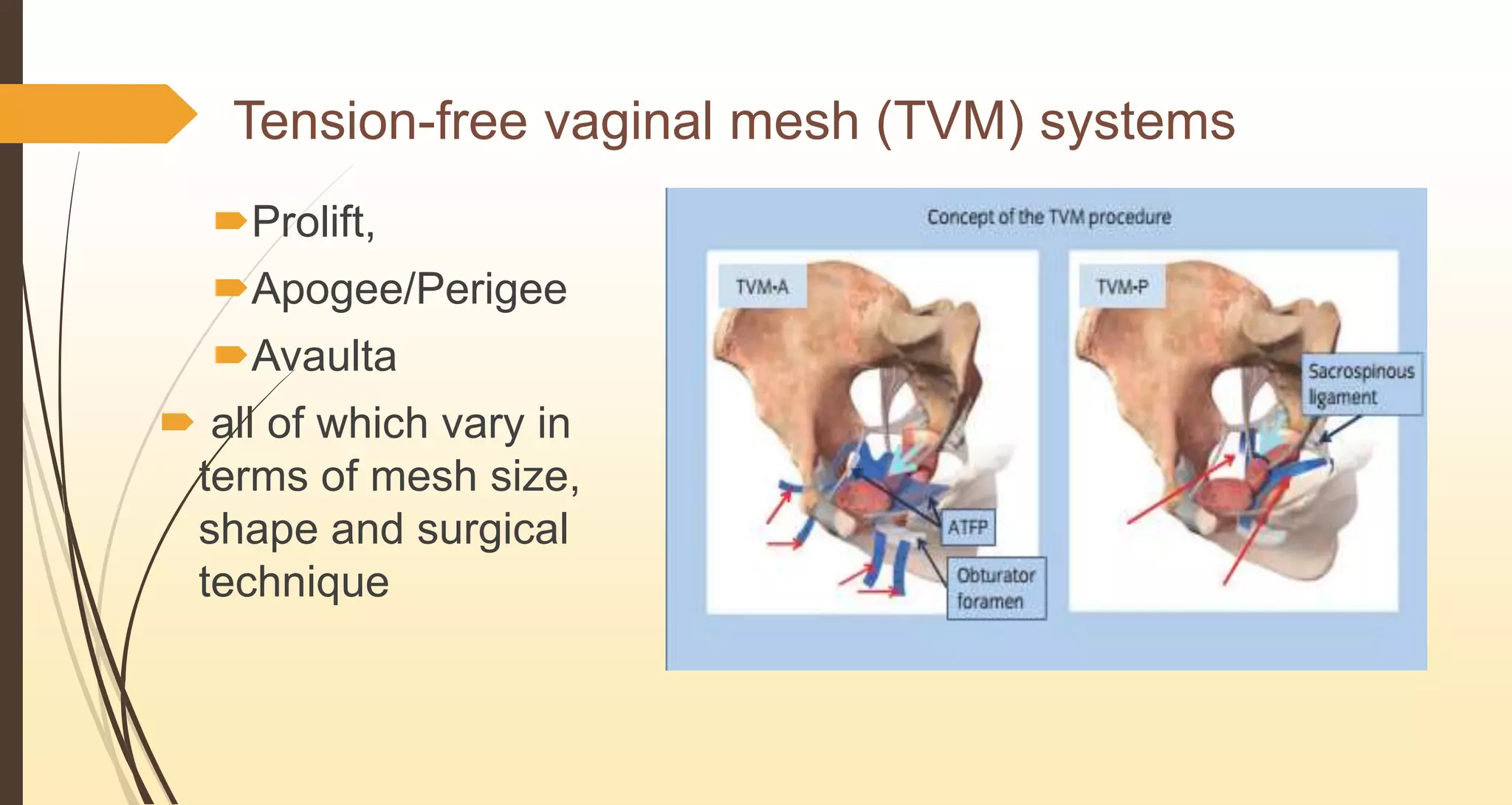 Classification & conservative surgeries for prolapse | PPTX