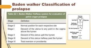 Classification & conservative surgeries for prolapse | PPTX
