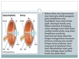 Indra penglihatan (mata) | PPTX
