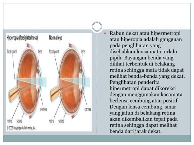 Indra penglihatan (mata) | PPTX
