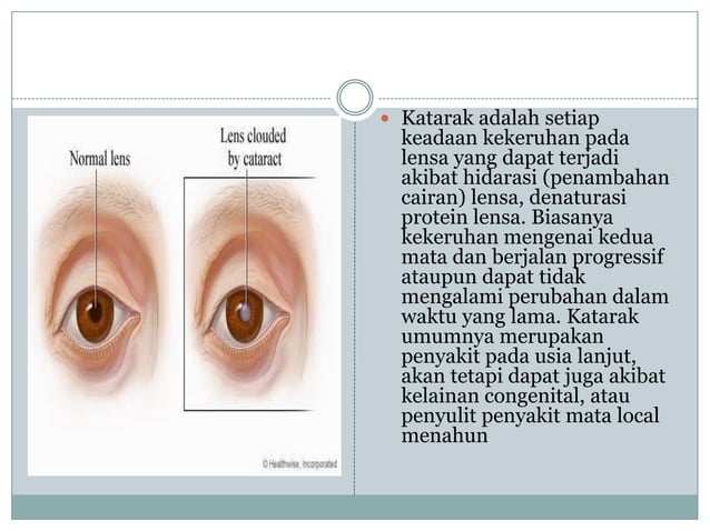 Indra penglihatan (mata) | PPTX