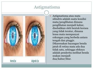 Indra penglihatan (mata) | PPTX