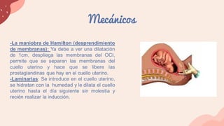 Inducción del parto.pdf