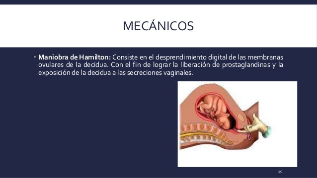 Inducción del trabajo de parto