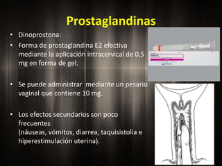 Induccion de trabajo de parto | PPTX