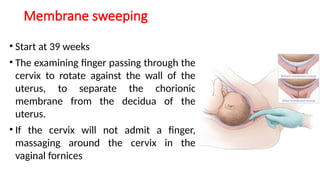 induction of labour obstetrics and gynecology.pptx
