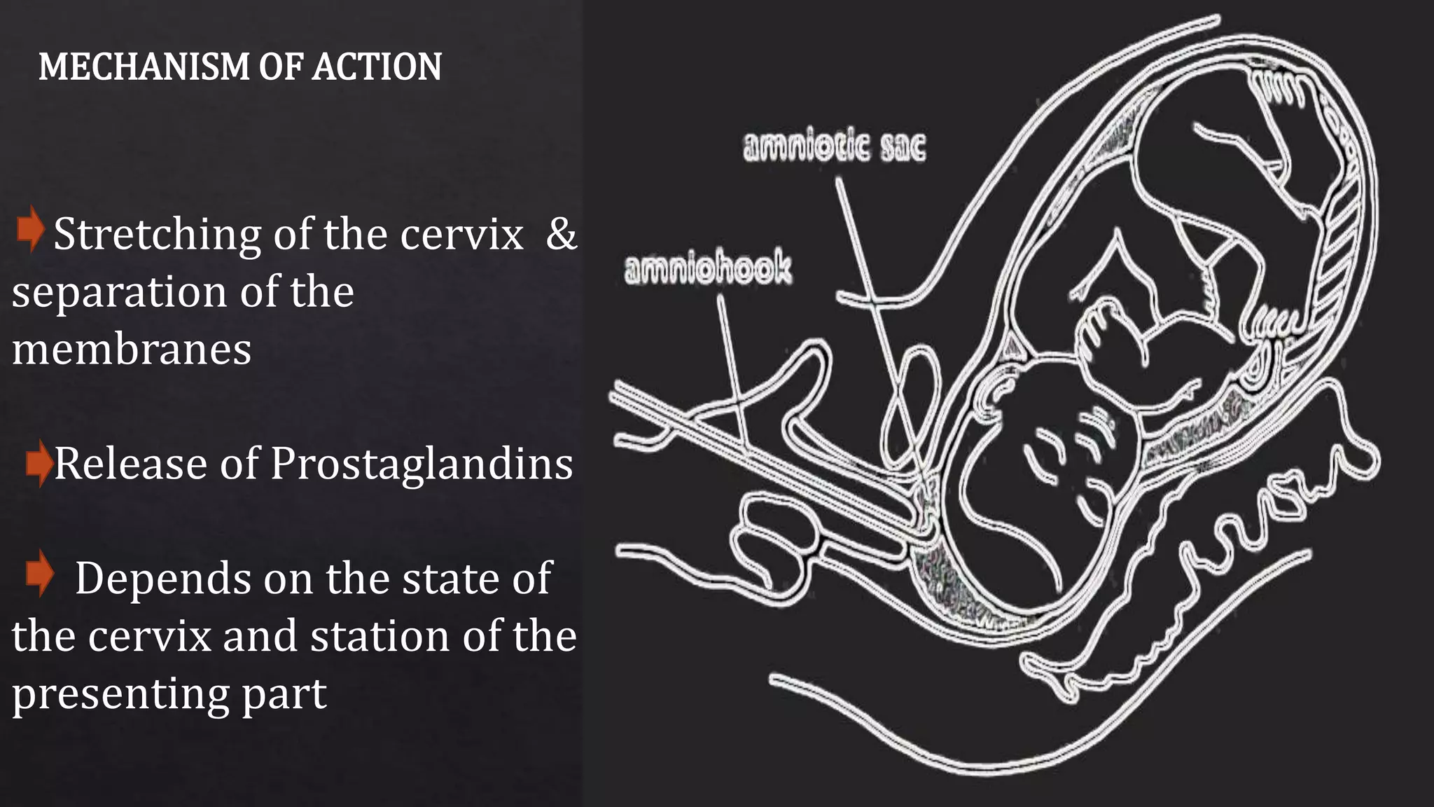 Induction and augmentation of labour by dr jograjiya | PPSX