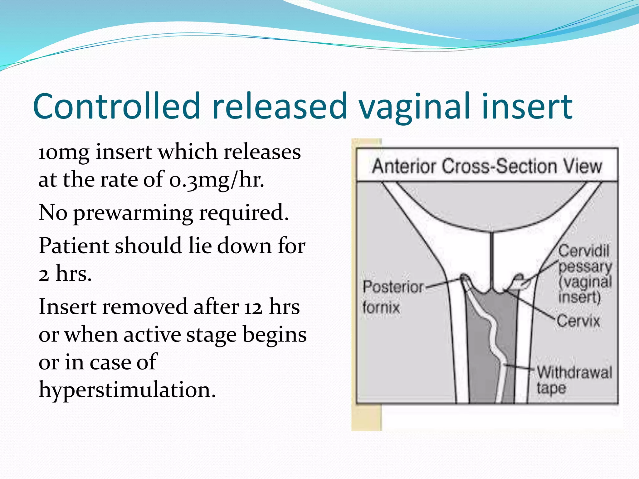 Induction and augmentation of labour | PPTX