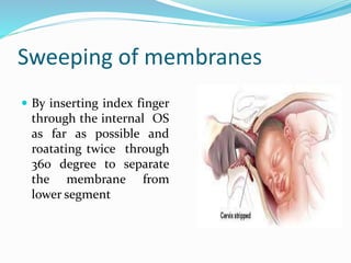 Induction and augmentation of labour | PPTX
