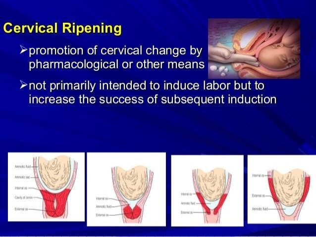 Induction and augmentation of labour