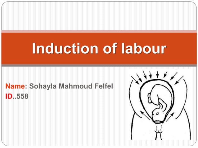 Induction of labor | PPT