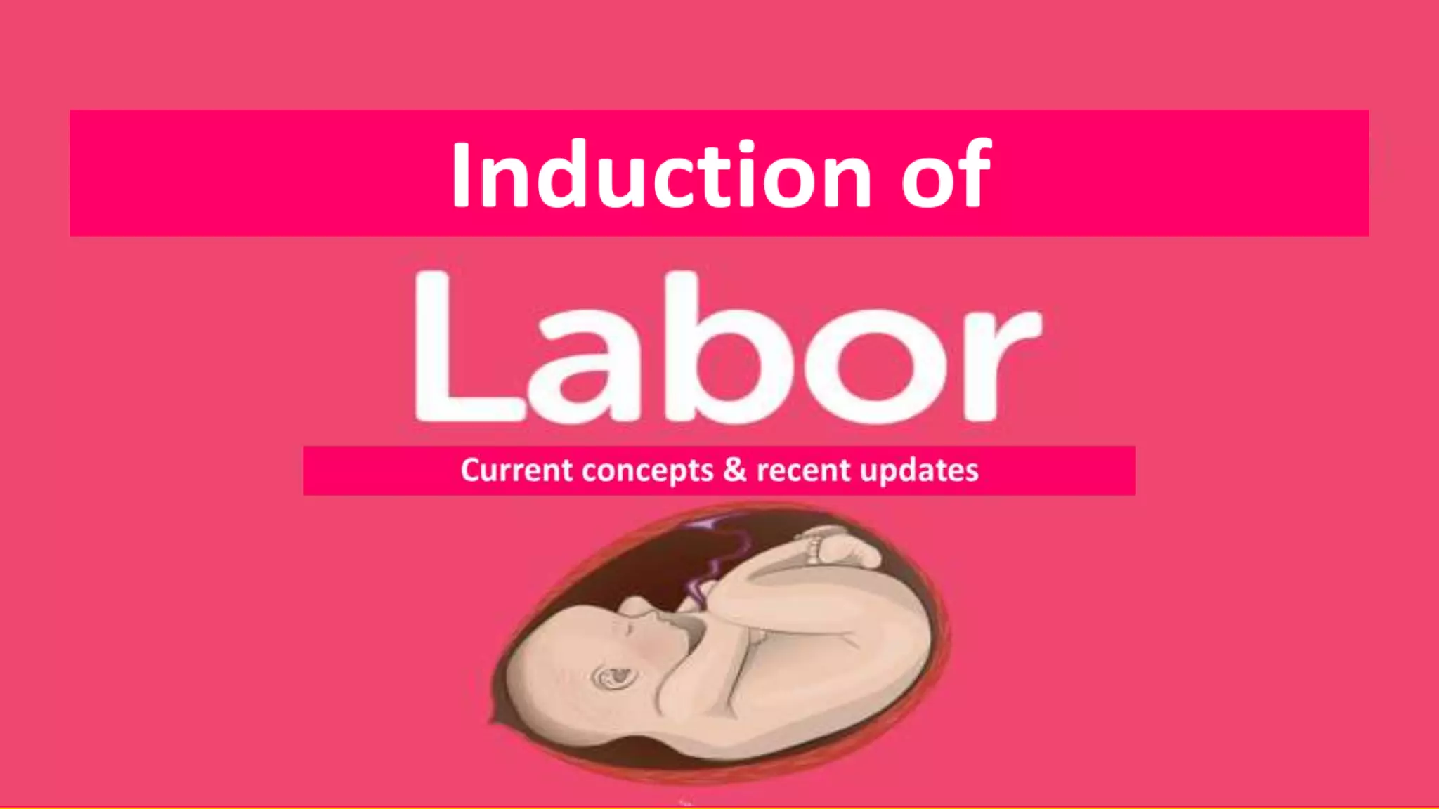 Induction of labour | PDF