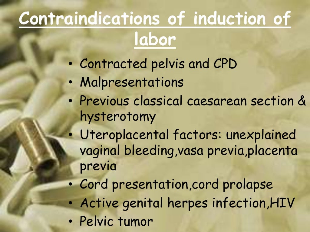 Induction of labour