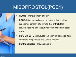 Induction of labour | PPTX