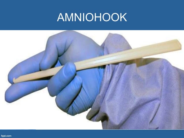 Induction of labour | PPTX | Pregnancy | Reproductive Health