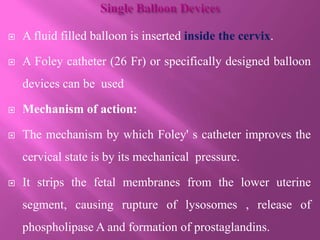 Induction of labour | PPTX