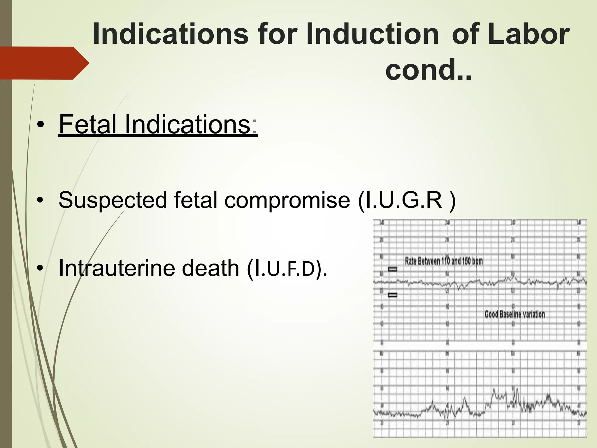Induction of labour | PPTX