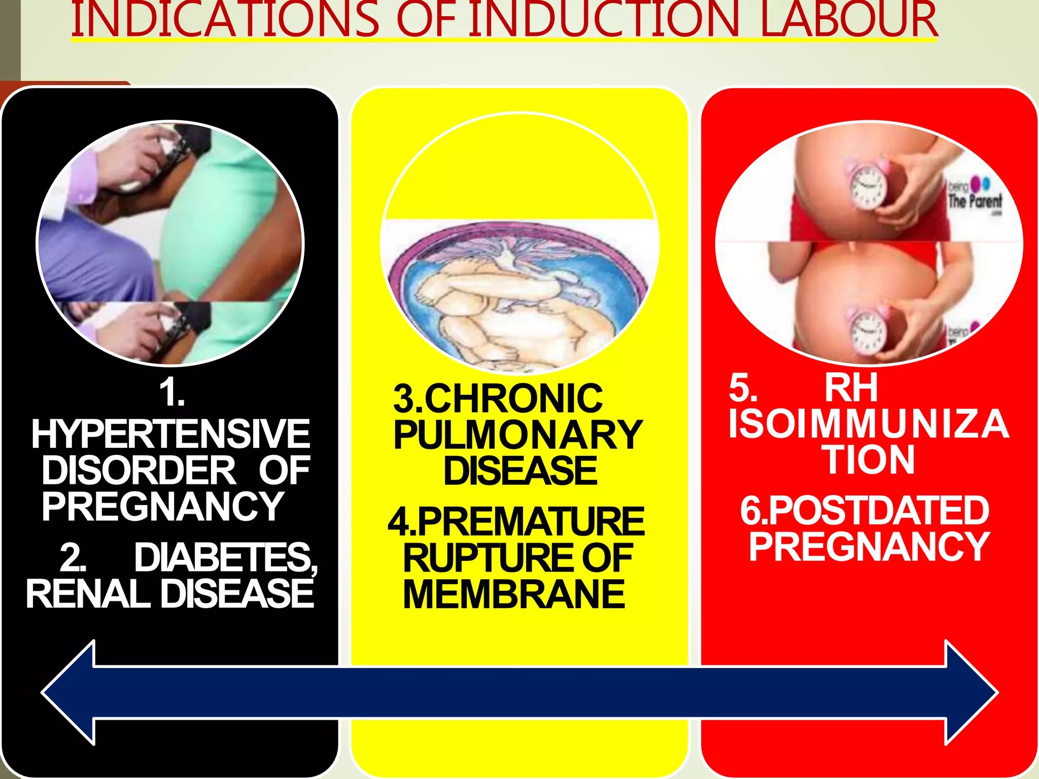 Induction of labour | PPTX