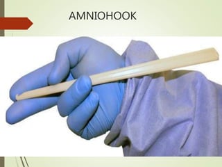 Induction of labour | PPT