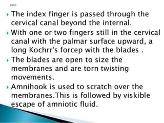 Induction of labour | PPT
