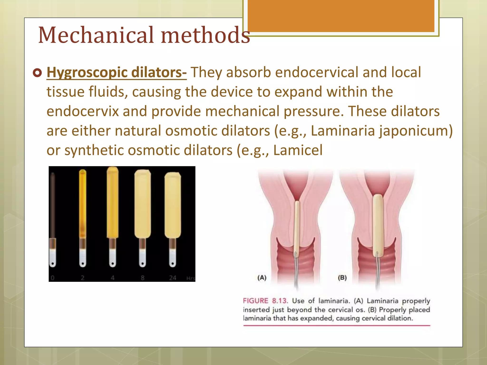Induction of labour | PPTX