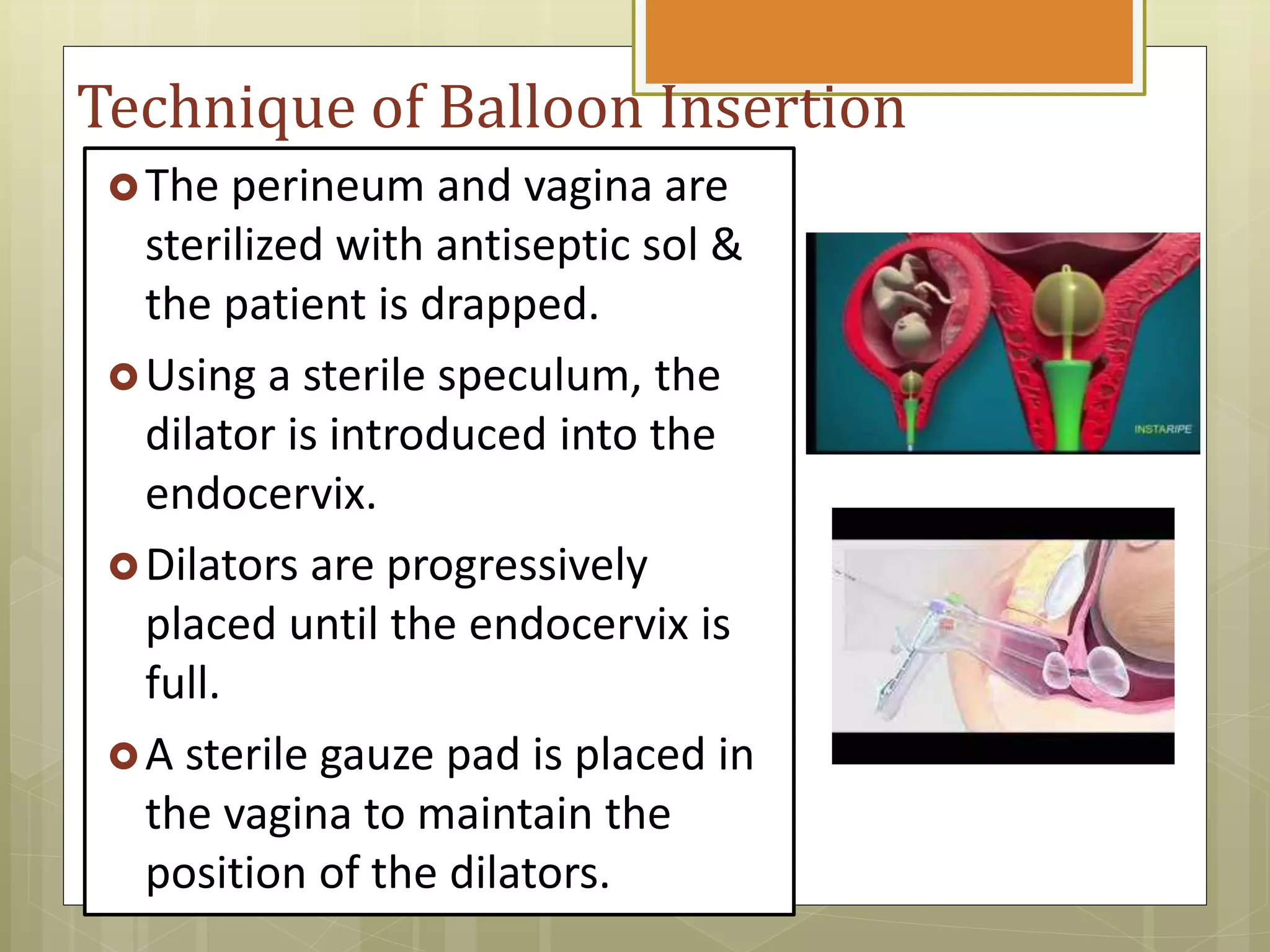 Induction of labour | PPTX