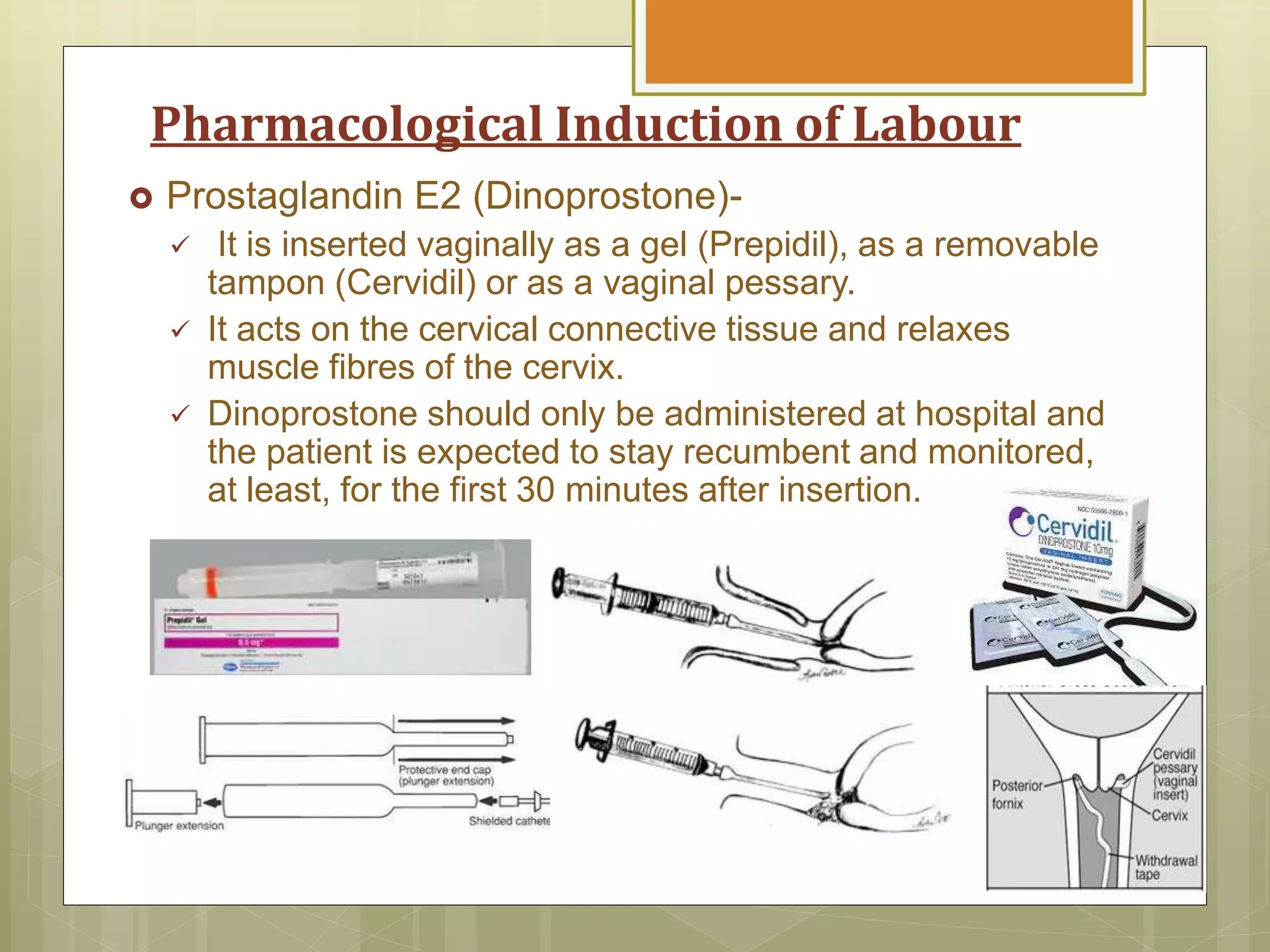 Induction of labour | PPTX