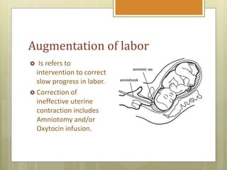 Induction of labour | PPTX