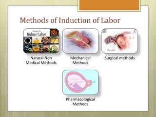 Induction of labour | PPTX
