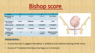 induction of labour (4)(1).pptx