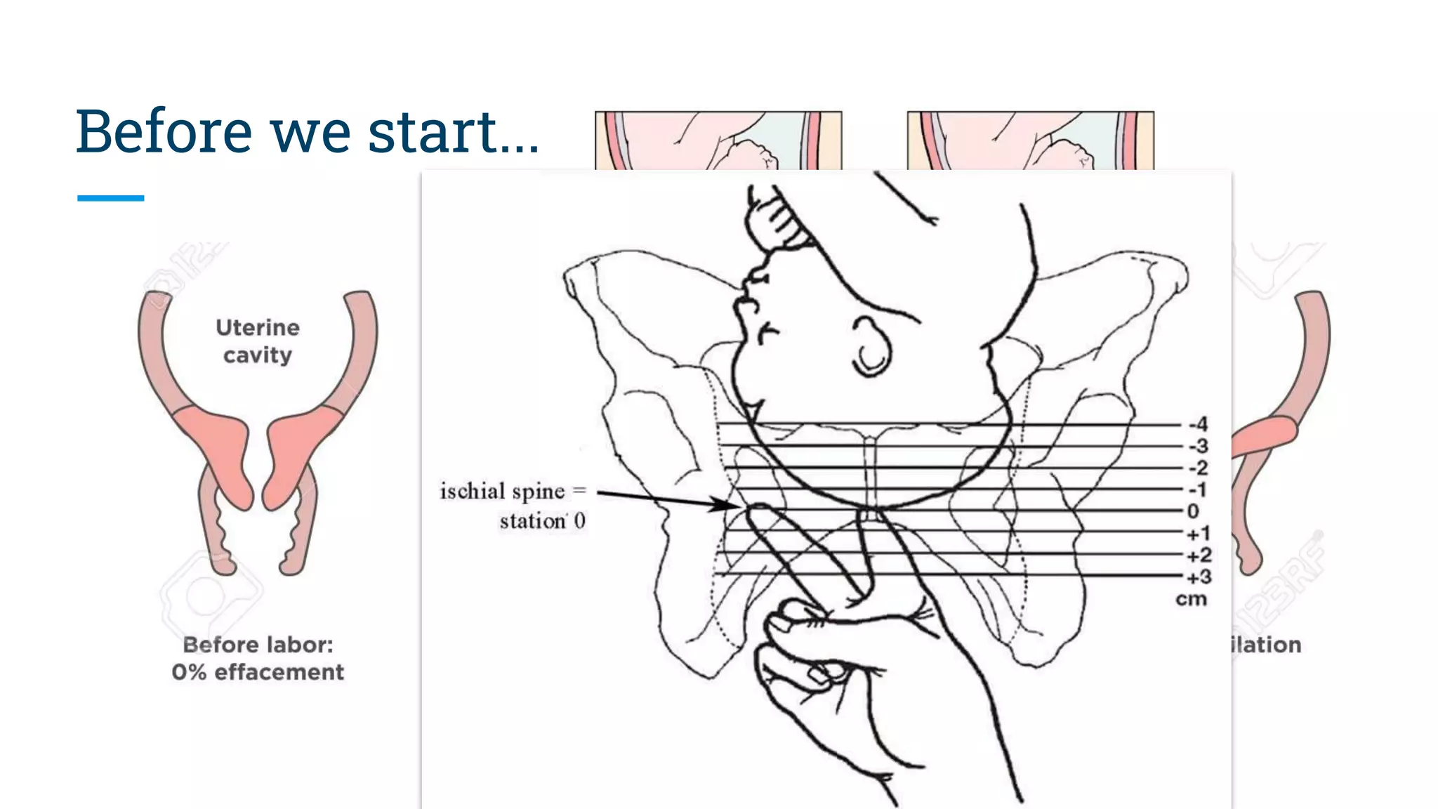 Induction of labour and prolonged pregnancy | PPT