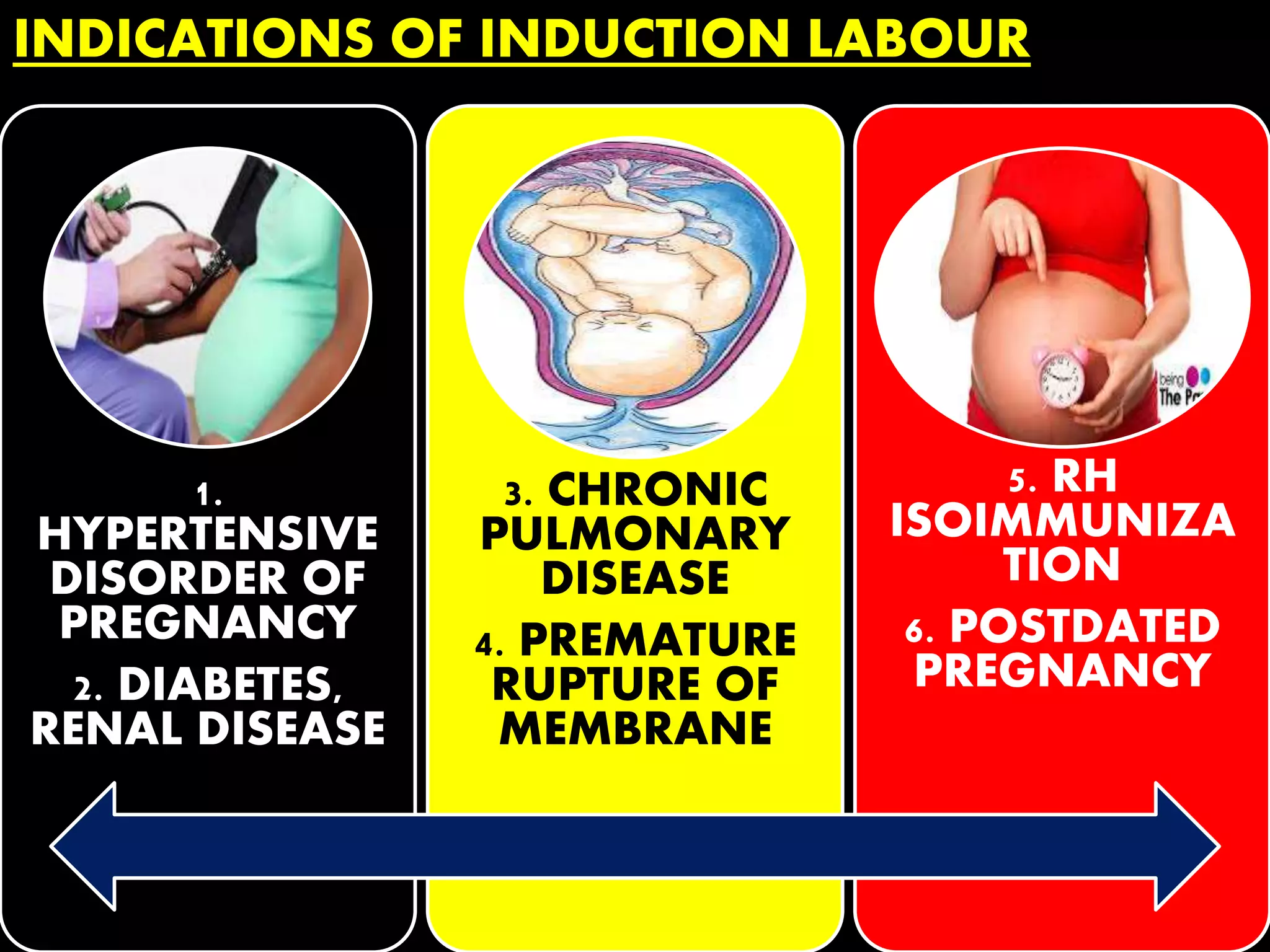 Induction of labour ppt | PPTX