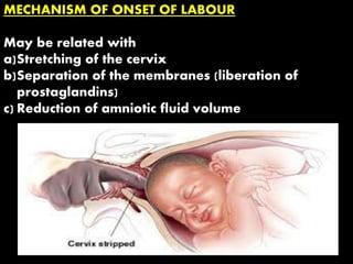 Induction of labour ppt | PPTX