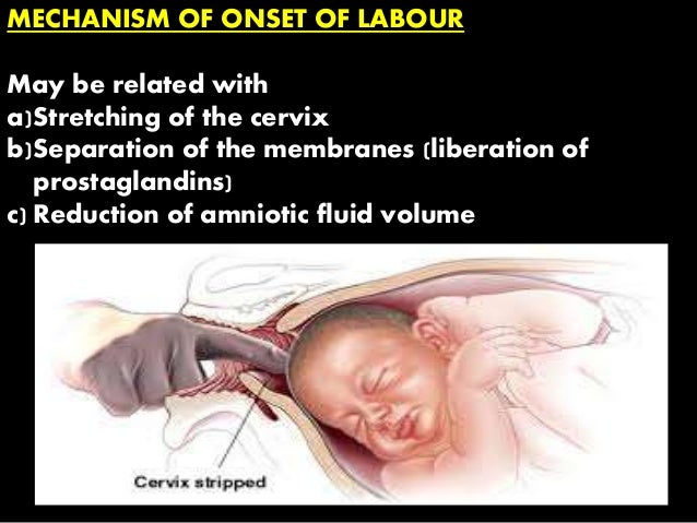Induction of labour ppt