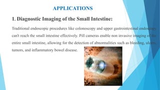 induja _PPT[1]. pill camera in medicine | PPTX