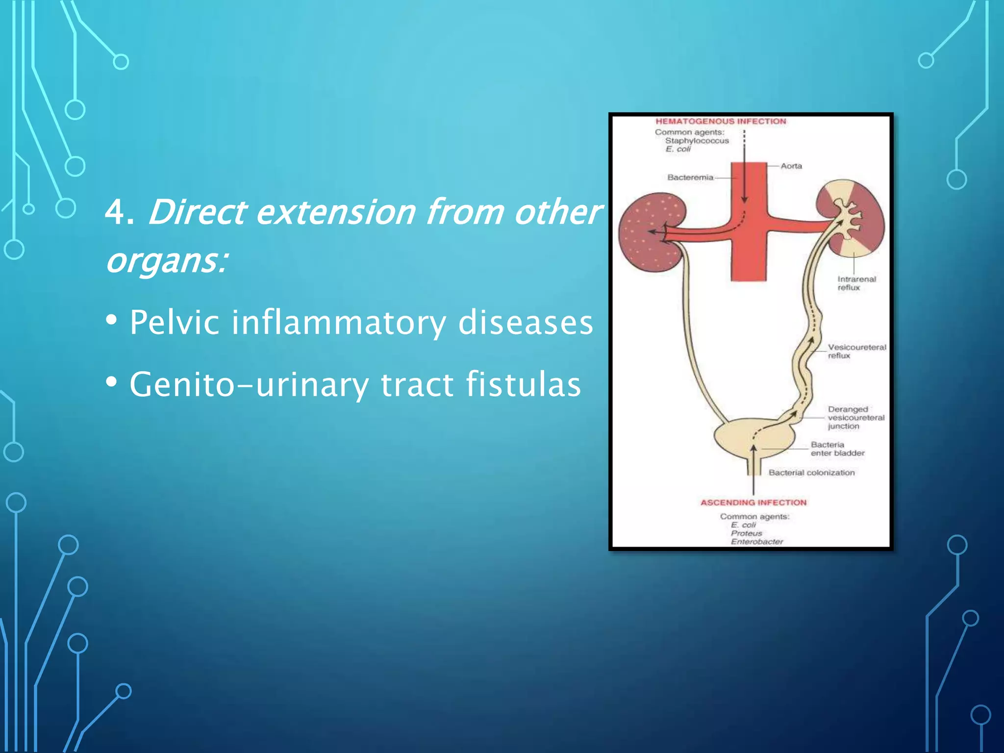 urinary tract infection | PPTX