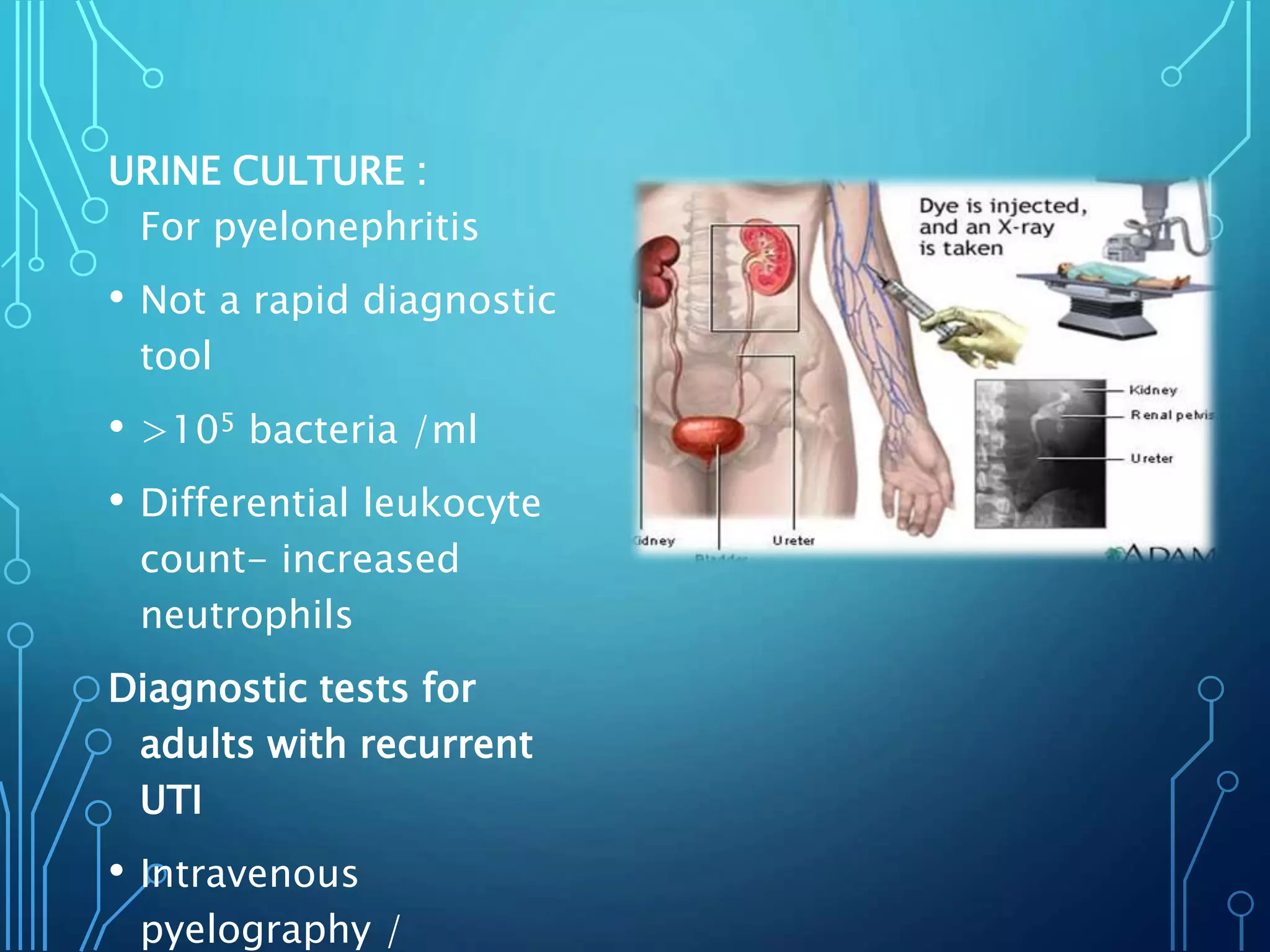 urinary tract infection | PPTX