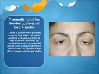 Inervacion ocular | PPTX