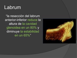 Inestabilidad del hombro y lesiones de labrum | PPTX