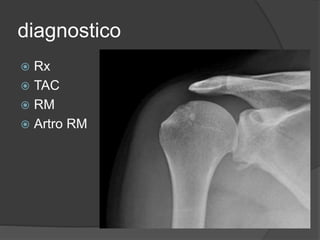 Inestabilidad del hombro y lesiones de labrum | PPTX