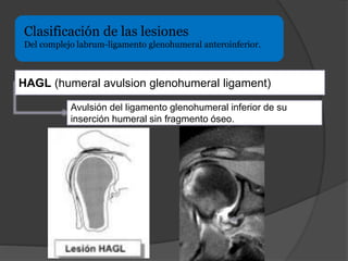 Inestabilidad del hombro y lesiones de labrum | PPTX